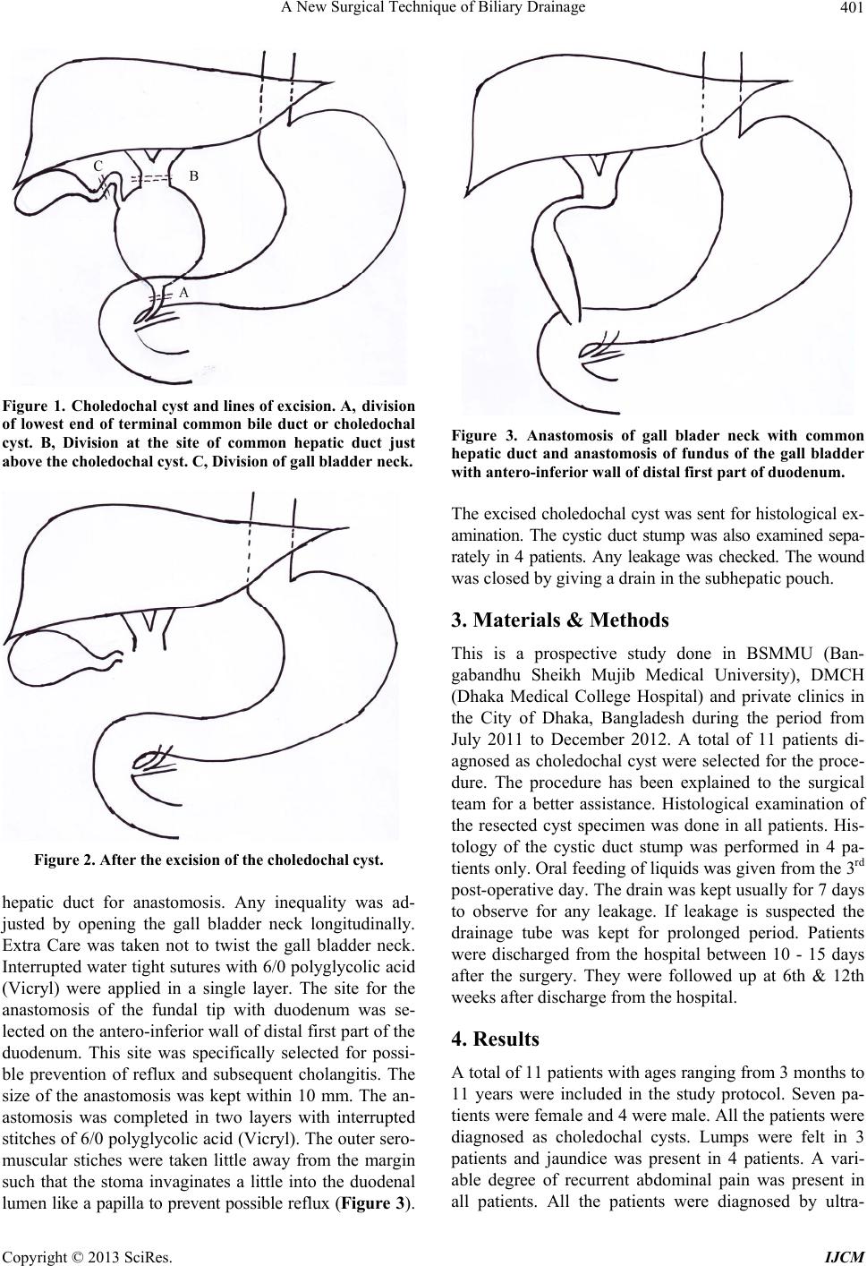 Roux En Y Hepaticojejunostomy