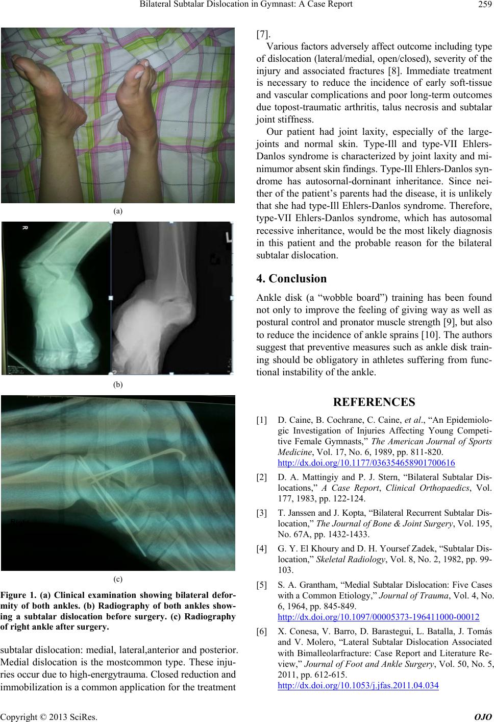 Bilateral Subtalar Dislocation in Gymnast: A Case Report