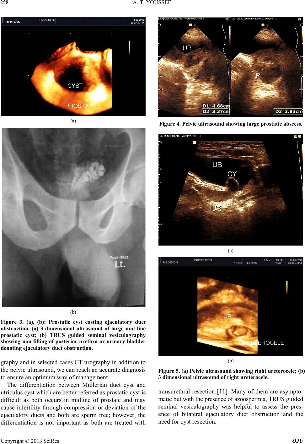 Radiological Evaluation of Lower Genitourinary Tract Cysts in Males