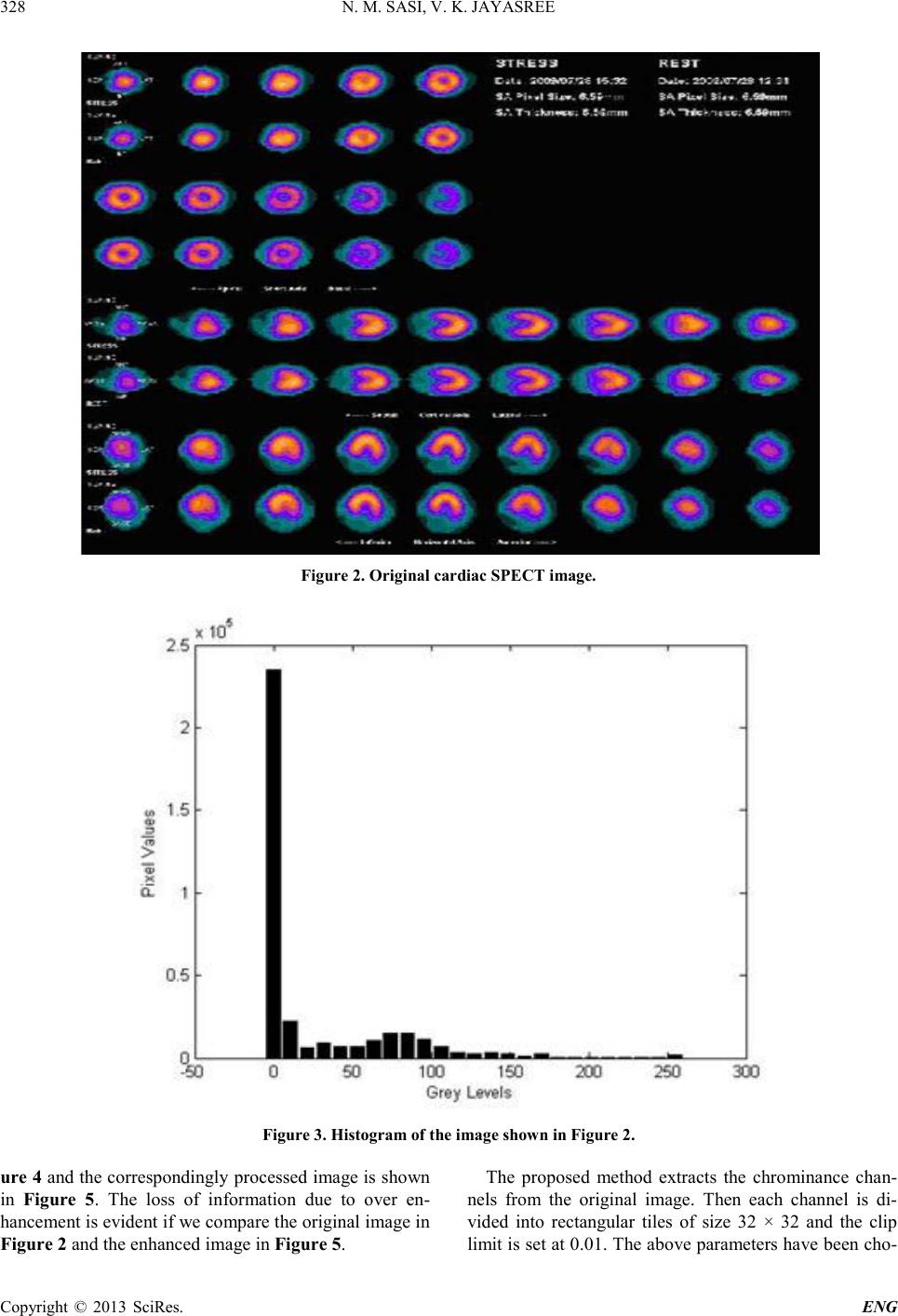 Contrast Limited Adaptive Histogram Equalization for Qualitative ...