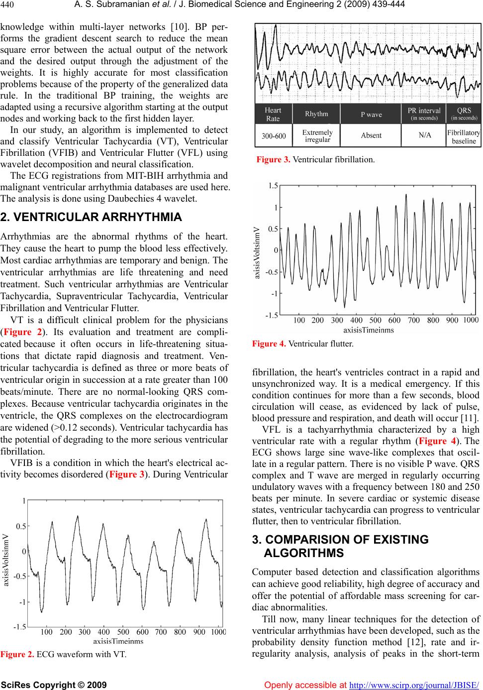 Wavelet based detection of ventricular arrhythmias with neural network classifier